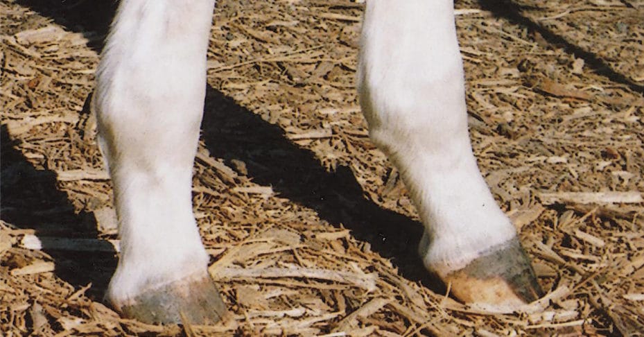 The Club Foot: Is it No Big Deal, or a Deal-Breaker?